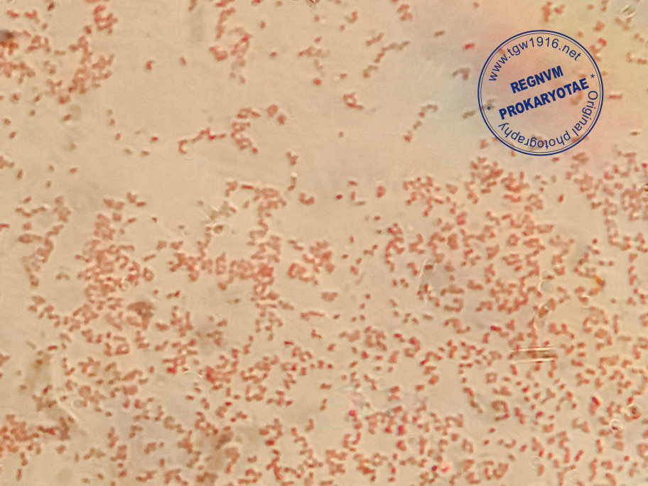 Coloracao Por Fluorescensgrama De Pseudomonas